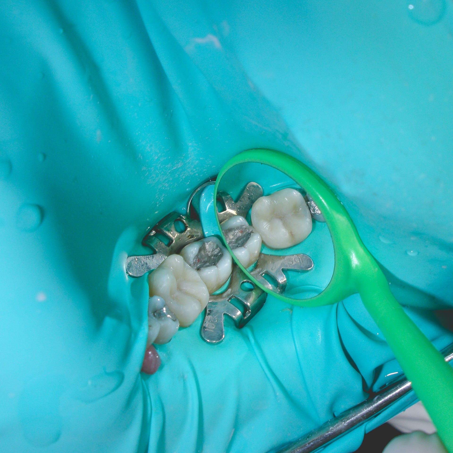 OLYMPUS DIGITAL CAMERA - ESTHETIC DENT