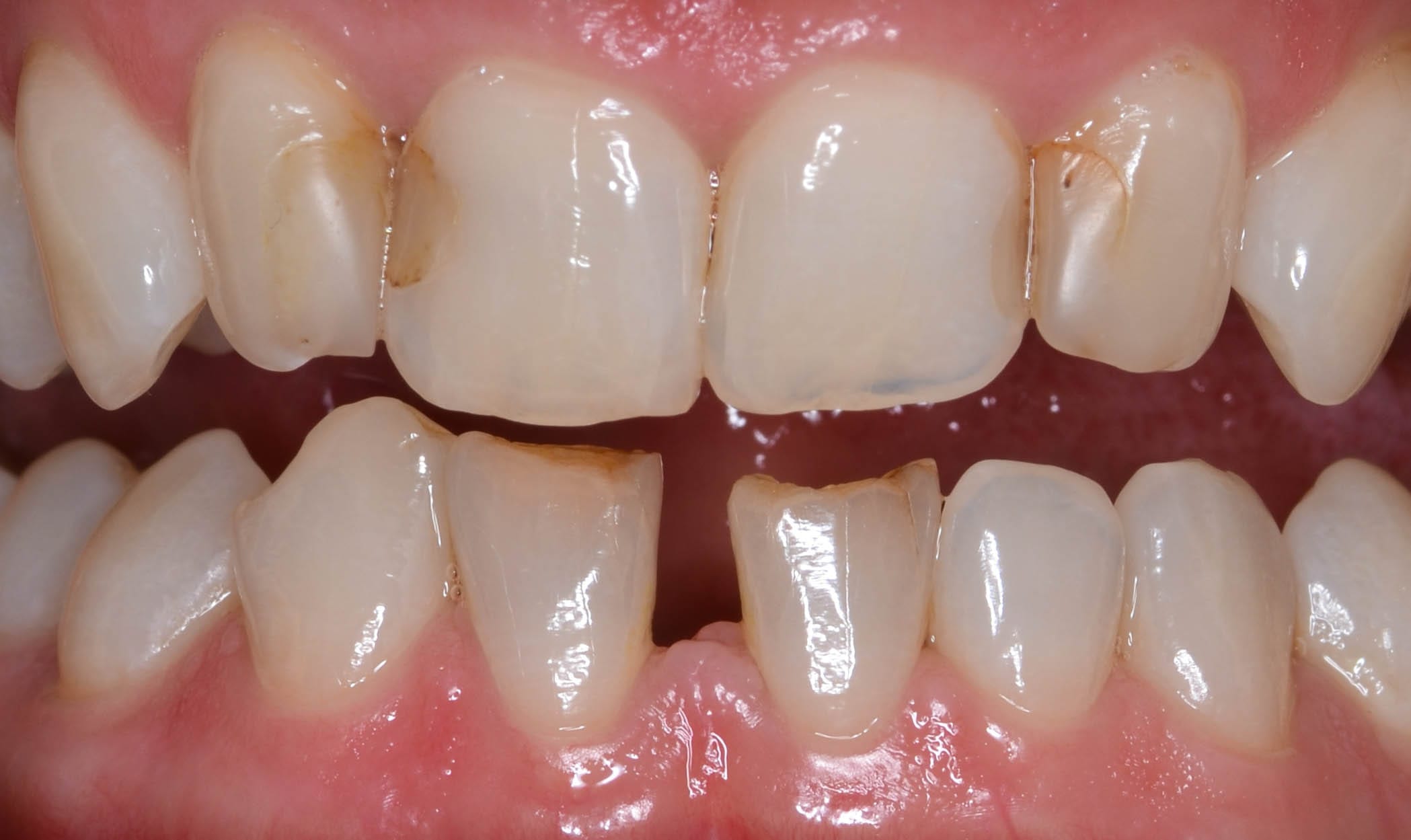 Služby | ESTHETIC DENT Frýdek-Místek